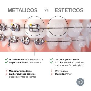 Diferencia entre brackets estéticos y metálicos - Loscos Ortodoncia